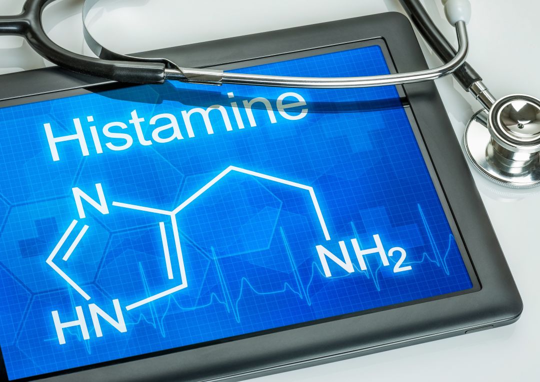 Nietolerancja histaminy czy alergia - jak je odróżnić? - ALAB laboratoria