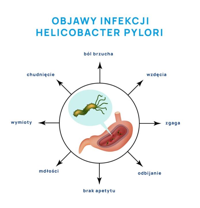 Helicobacter pylori - przyczyny i objawy zakażenia, badania