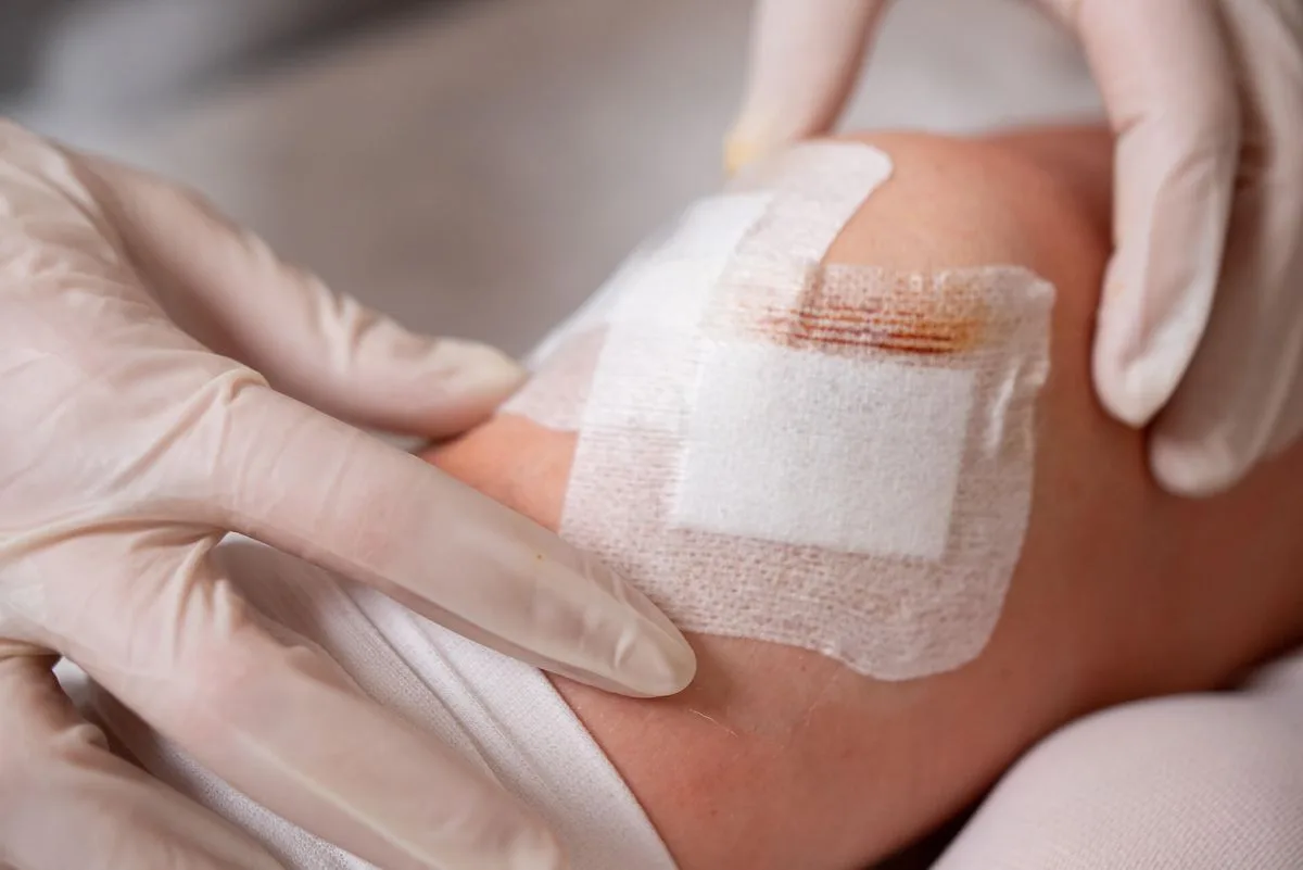 Zakażenie rany - przyczyny, diagnostyka, leczenie