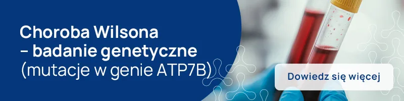 Choroba Wilsona: jak nadmiar miedzi wpływa na organizm? - Centrum ...