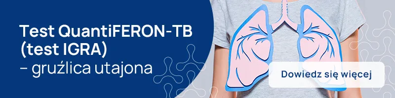 Czym jest test Quantiferon? - Centrum Wiedzy ALAB laboratoria