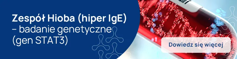 Choroba Hioba (zespół hiper IgE) – objawy, przyczyny, diagnostyka ...