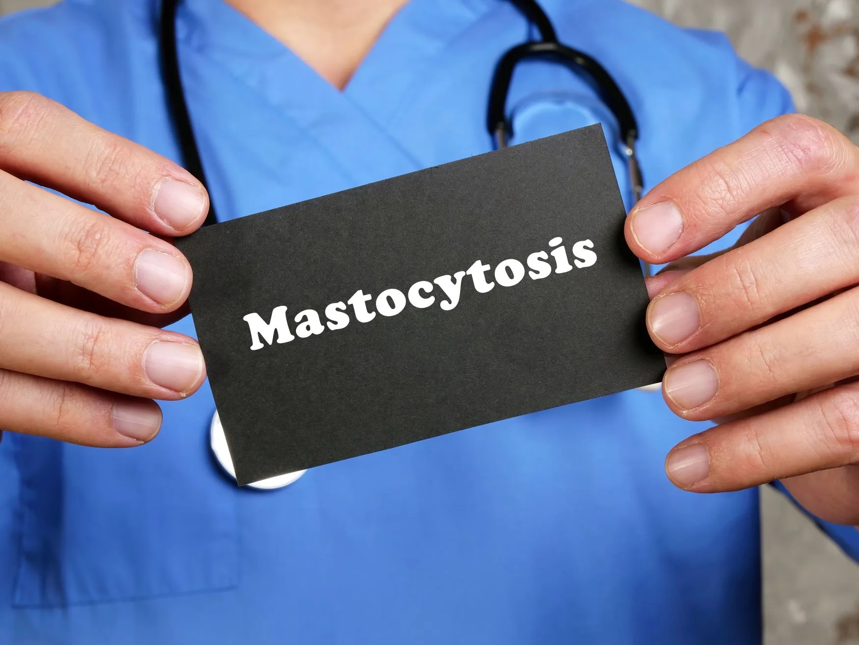 Mastocytoza - objawy, rodzaje, diagnostyka i leczenie - Centrum Wiedzy ...