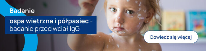Półpasiec - przyczyny, objawy, diagnostyka, leczenie i powikłania