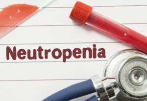 Neutropenia (niski poziom neutrofili): przyczyny, objawy, leczenie