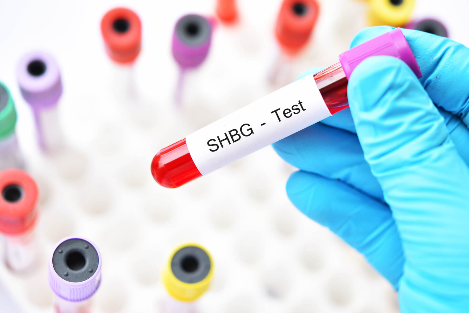 SHBG -co to za badanie? Wartości referencyjne u kobiet i mężczyzn ...