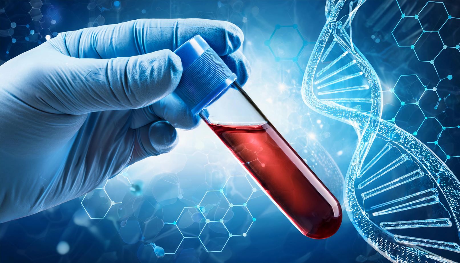 Badanie PCR – czym jest, kiedy się je wykonuje i jak przebiega ...