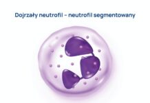 Neutropenia (niski poziom neutrofili): przyczyny, objawy, leczenie