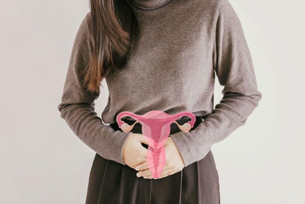 Potworniak (teratoma) jajnika – objawy, przyczyny, diagnostyka i ...