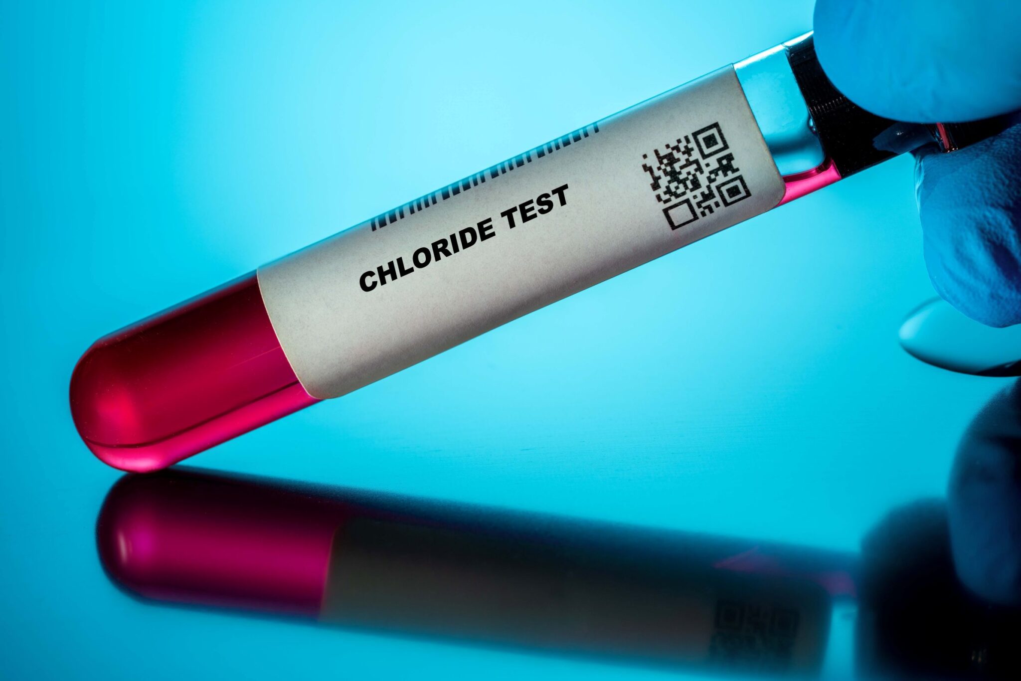Podwyższone chlorki we krwi (hiperchloremia) – co oznaczają i jak ...